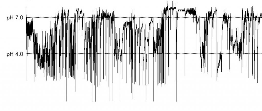 GiKids - pH Impedance Study