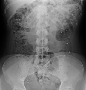 GiKids - Sitz Marker Study